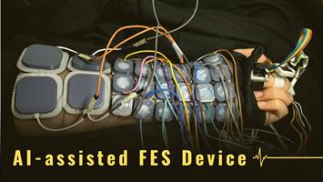 AI assisted FES Device | James Dyson Award